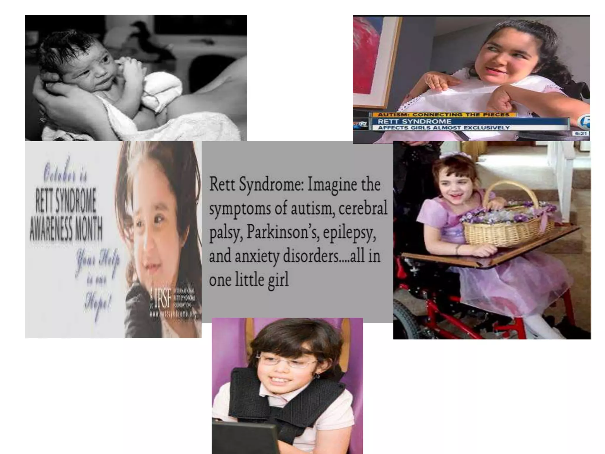 Autistic Spectrum Disorders | PPTX