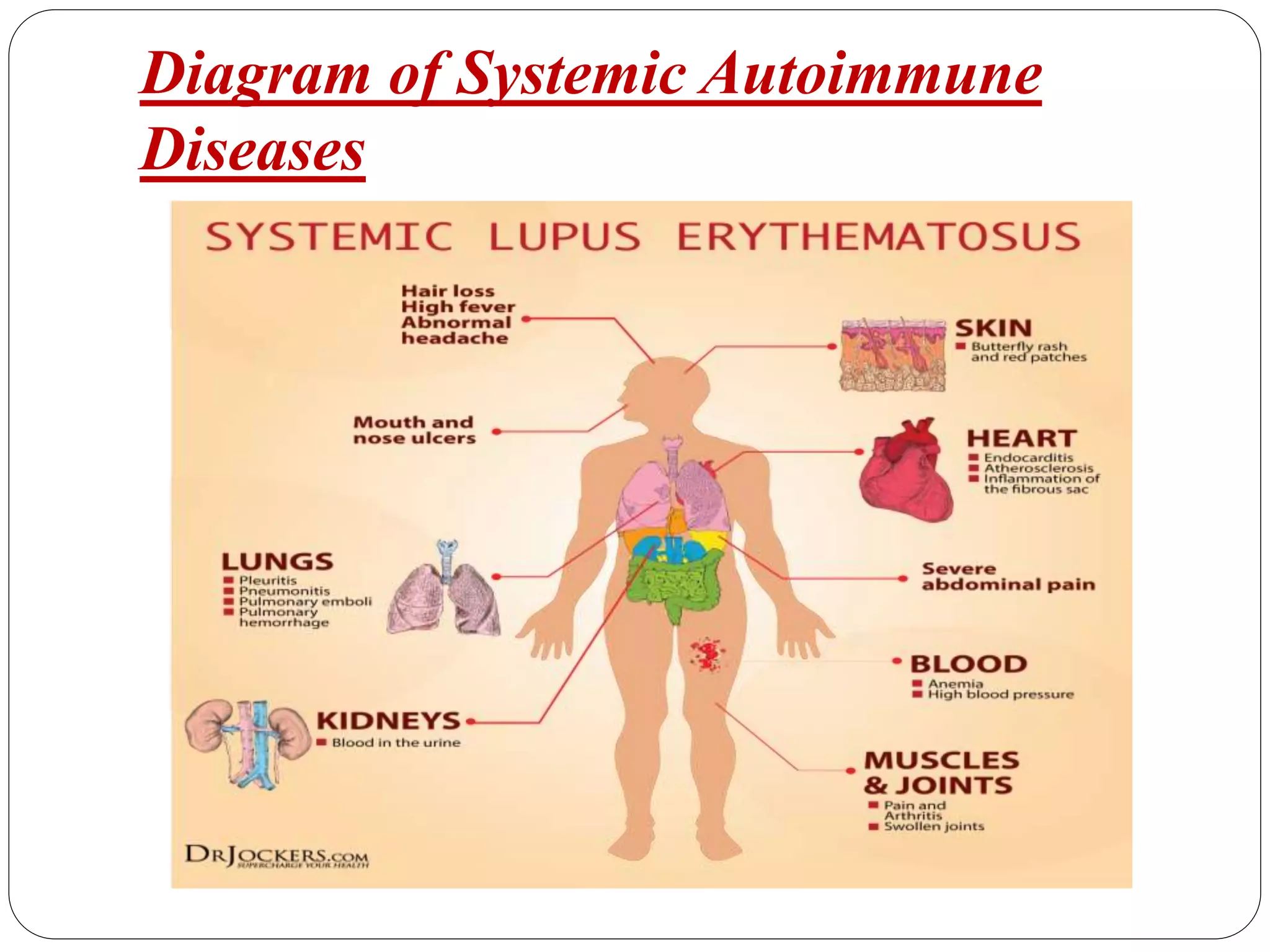 Auto immune diseases | PPTX