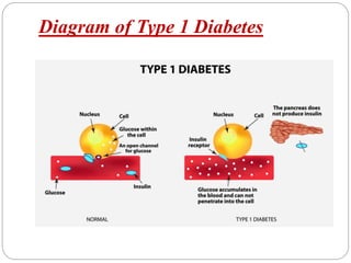 Auto immune diseases | PPTX