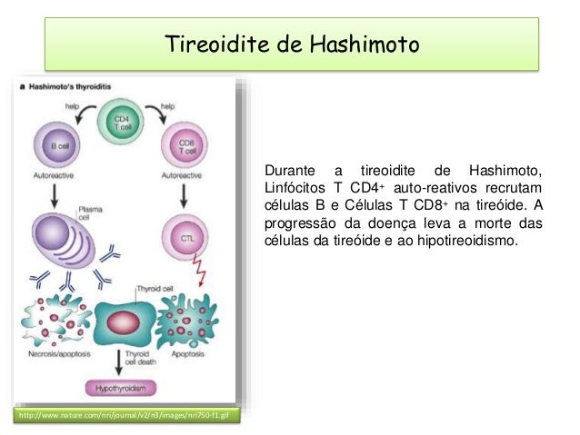 Imunologia 16 Distrbio De Hipersensibilidade Tipo 1