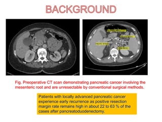 Auto-intestine transplant for Pancreatic Cancer.ppt