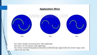 Auto-refractometer, Tonometer and DO.pptx