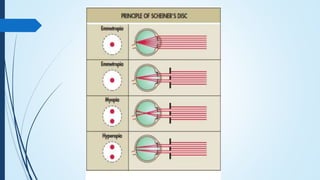 Auto-refractometer, Tonometer and DO.pptx