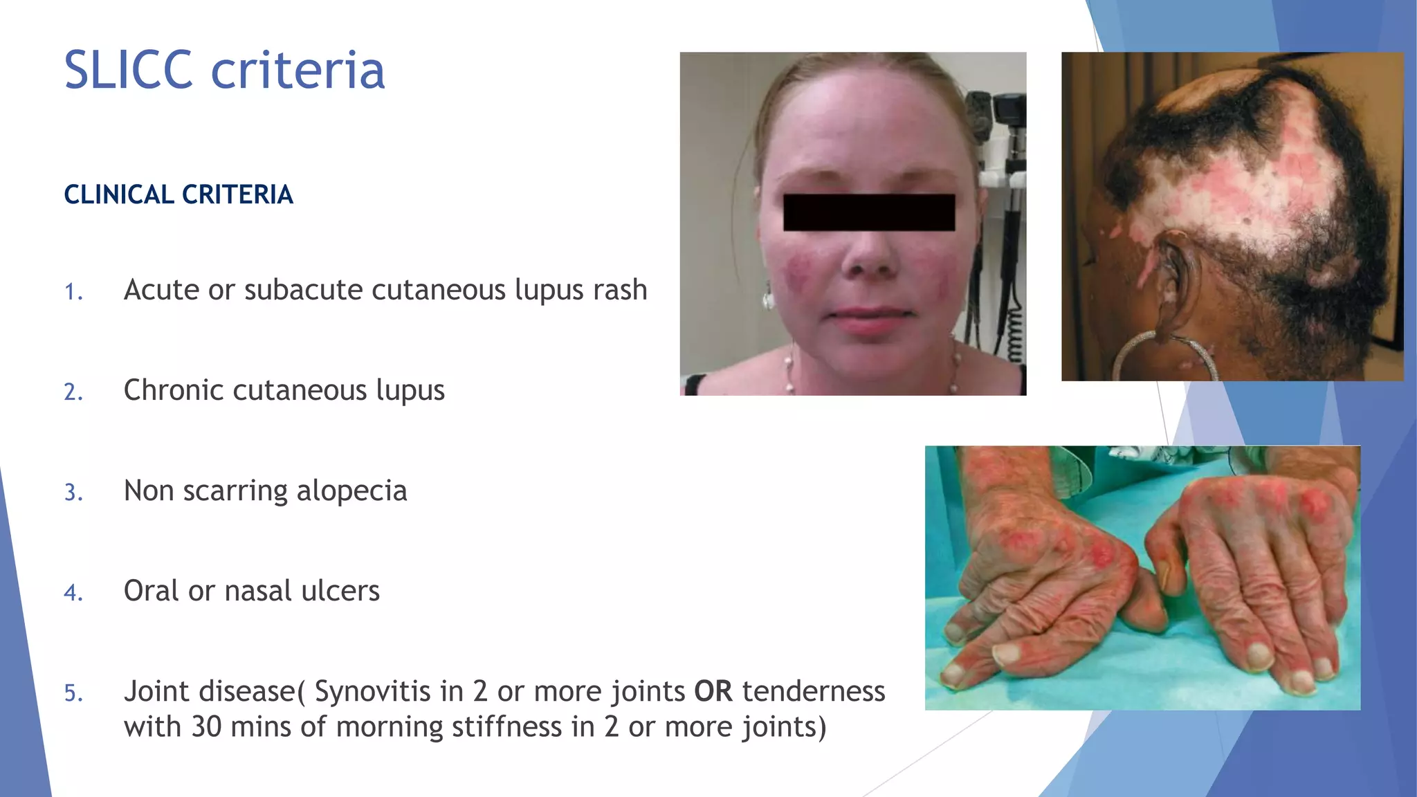 Autoantibody testing in CTD.pptx