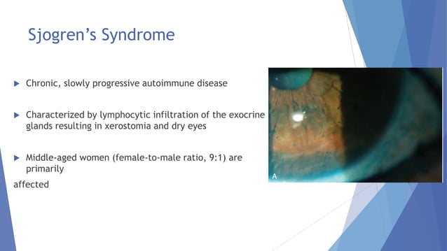 Autoantibody testing in CTD.pptx | Blood Disorders | Diseases and ...