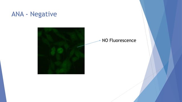 Autoantibody testing in CTD.pptx | Blood Disorders | Diseases and ...