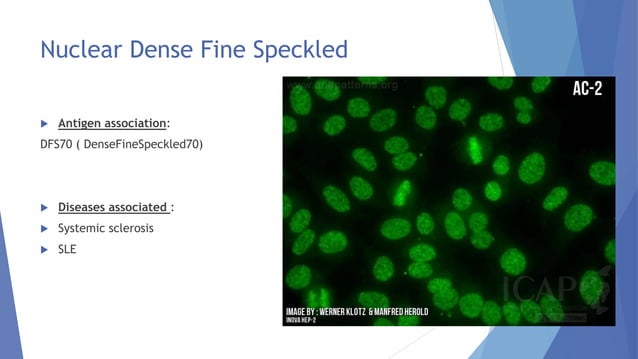 Autoantibody testing in CTD.pptx | Blood Disorders | Diseases and ...