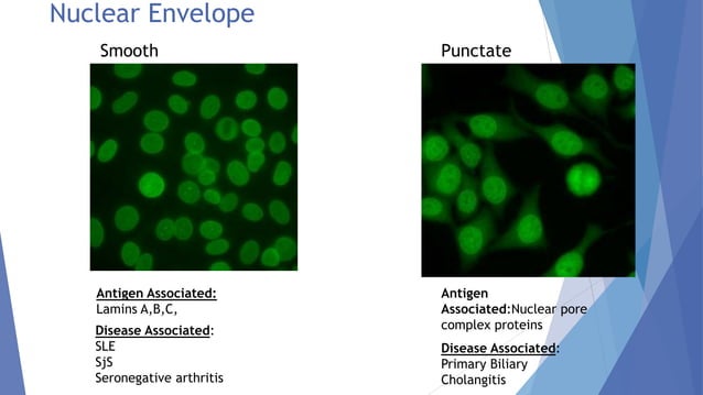 Autoantibody testing in CTD.pptx | Blood Disorders | Diseases and ...
