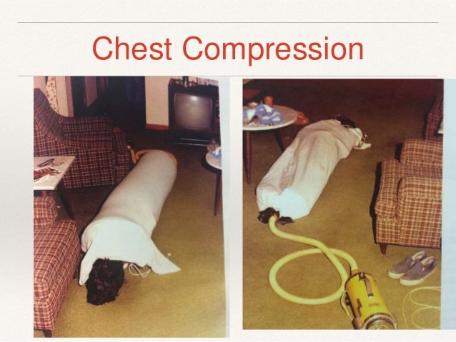 Autoerotic Asphyxiation Death