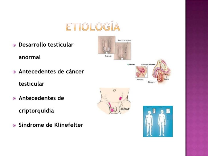 Autoexploración Testicular