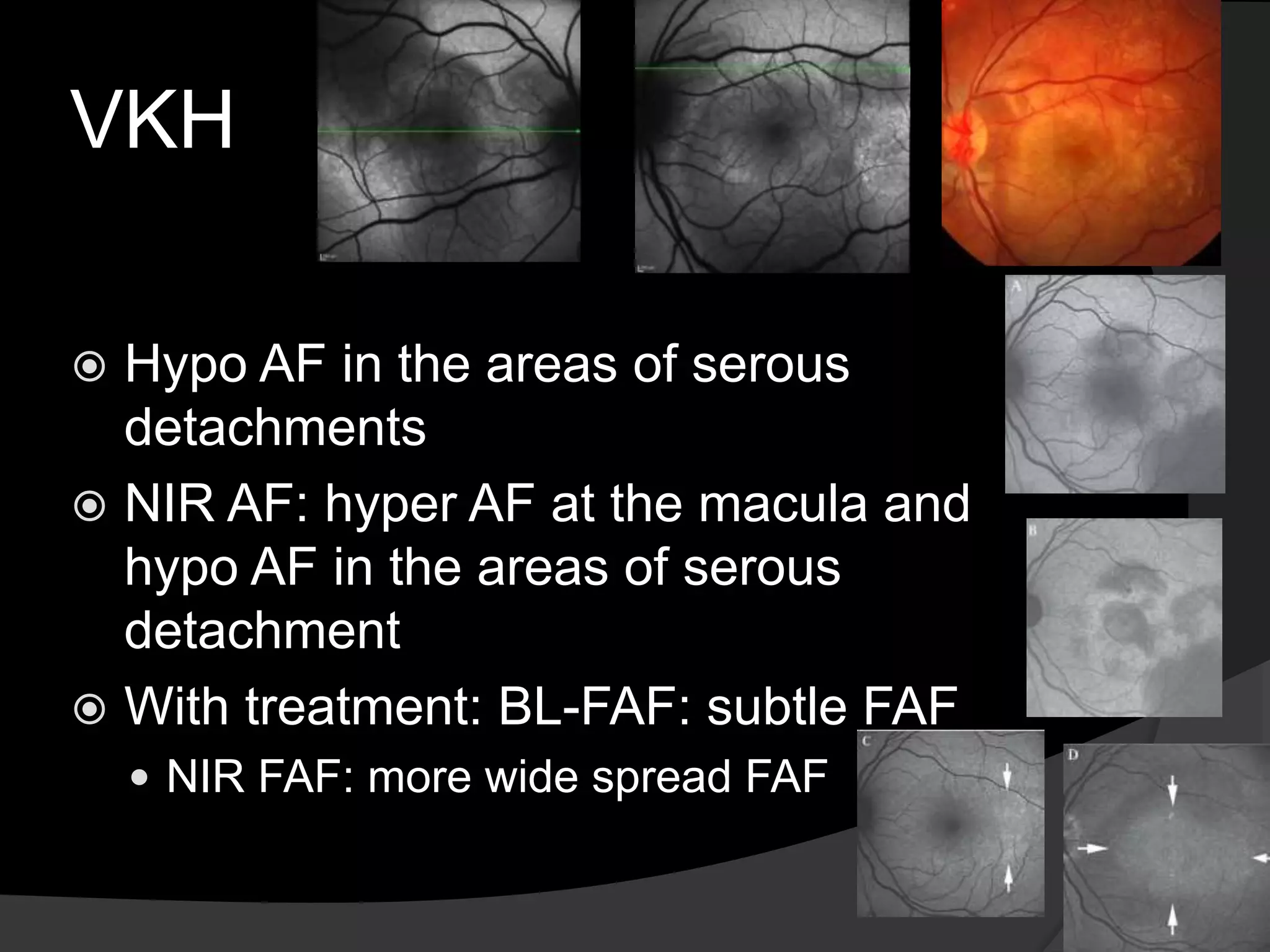 Autofluorescence | PPTX