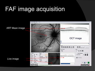 Autofluorescence | PPTX