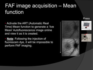 Autofluorescence | PPTX