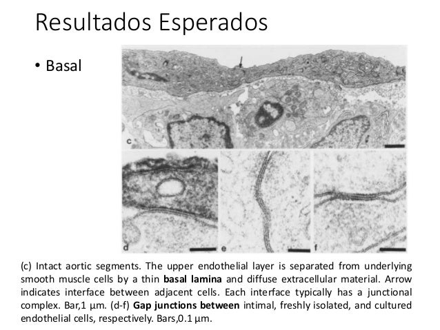 Uniones intercelulares - Microscopia Electrónica