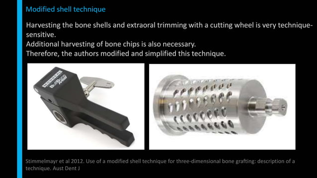 Autogenous bone graft harvesting | PPTX | Bone and Joint Conditions ...