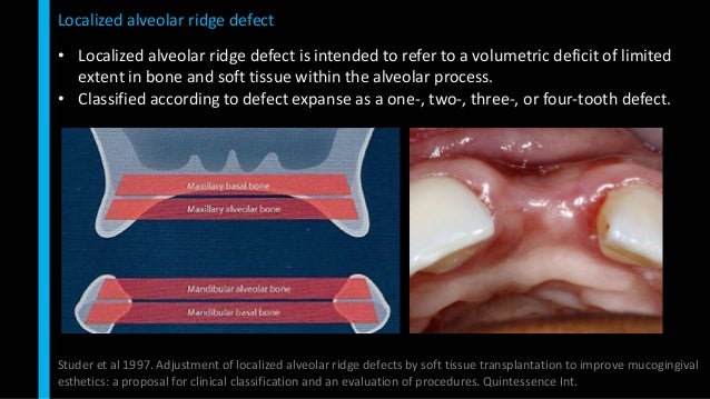 Autogenous bone graft harvesting