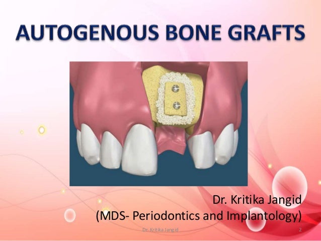 Autogenous bone grafting