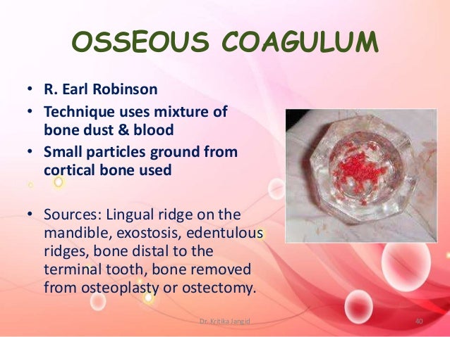 Autogenous bone grafting