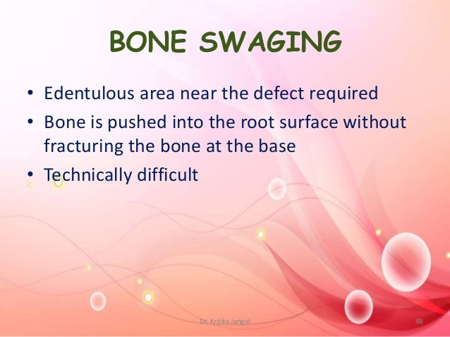 Autogenous bone grafting