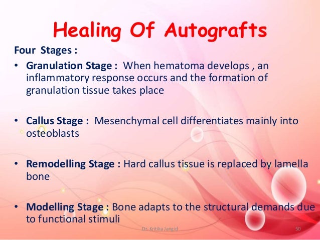 Autogenous bone grafting