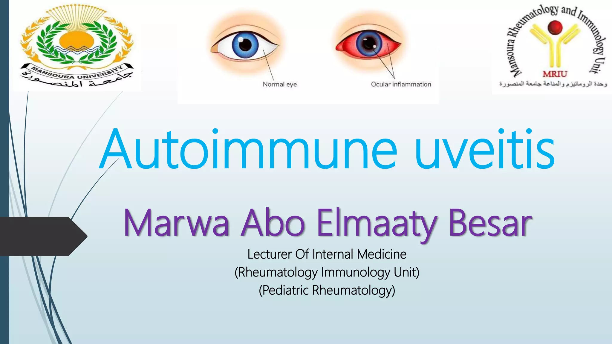 Autoimmue uveitis | PPTX
