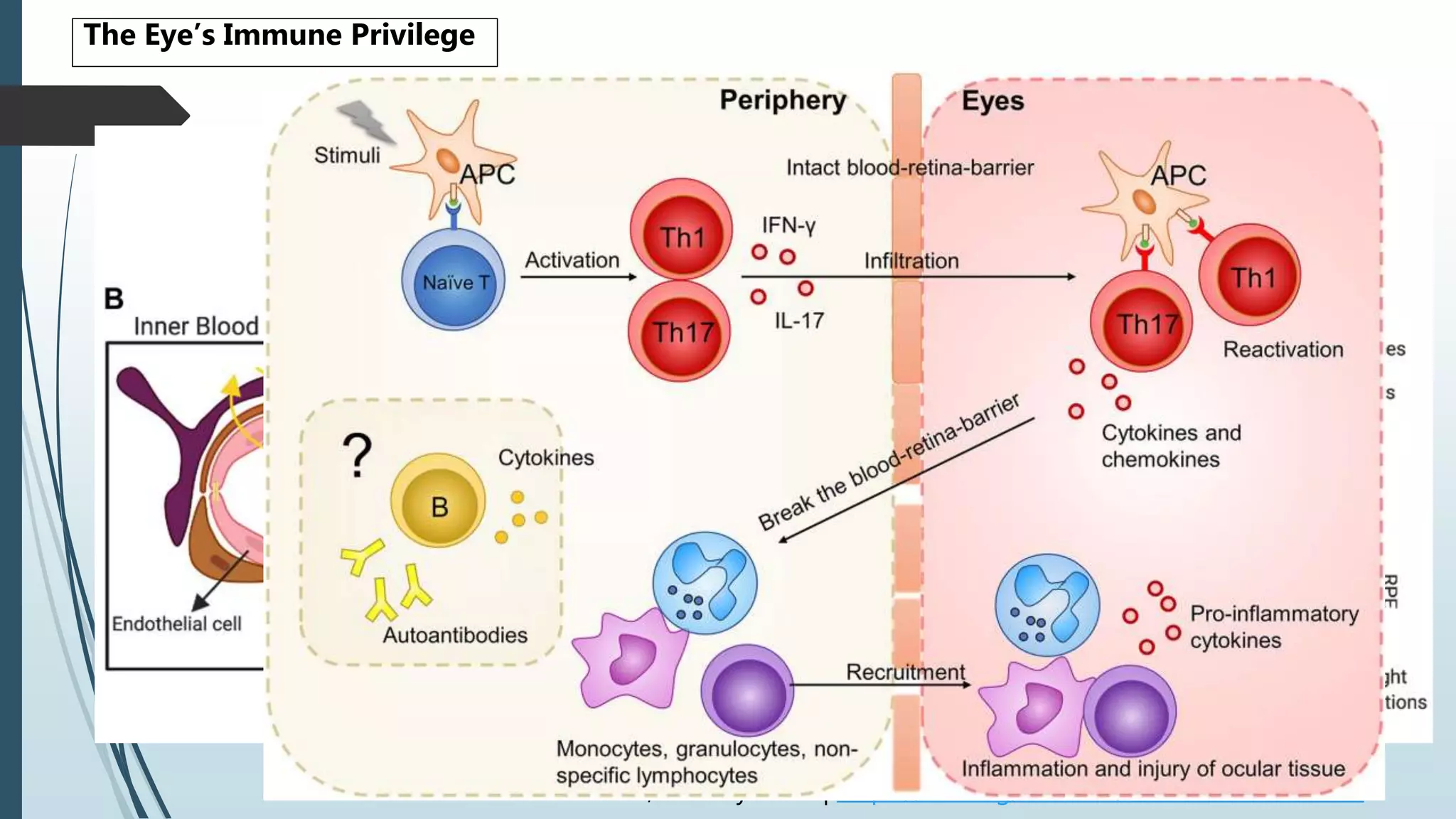 Autoimmue uveitis | PPTX