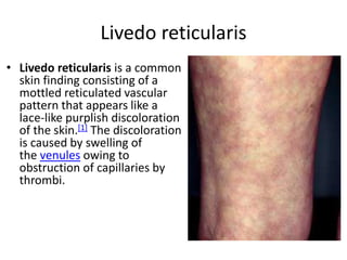 Autoimmune | PPTX