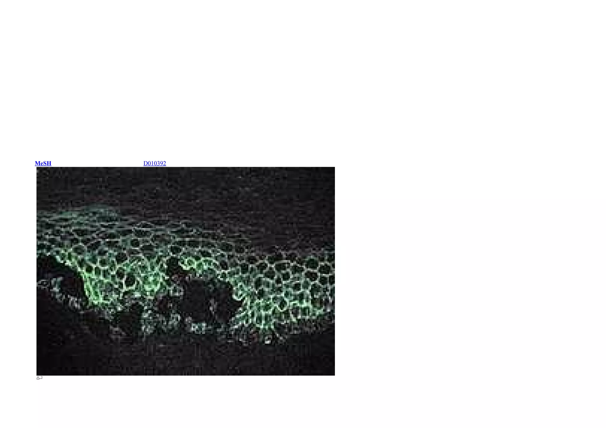 Autoimmune bullous dermatoses | DOC