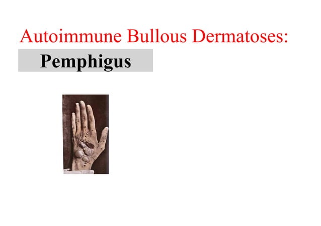 Autoimmune bullous dermatoses | DOC