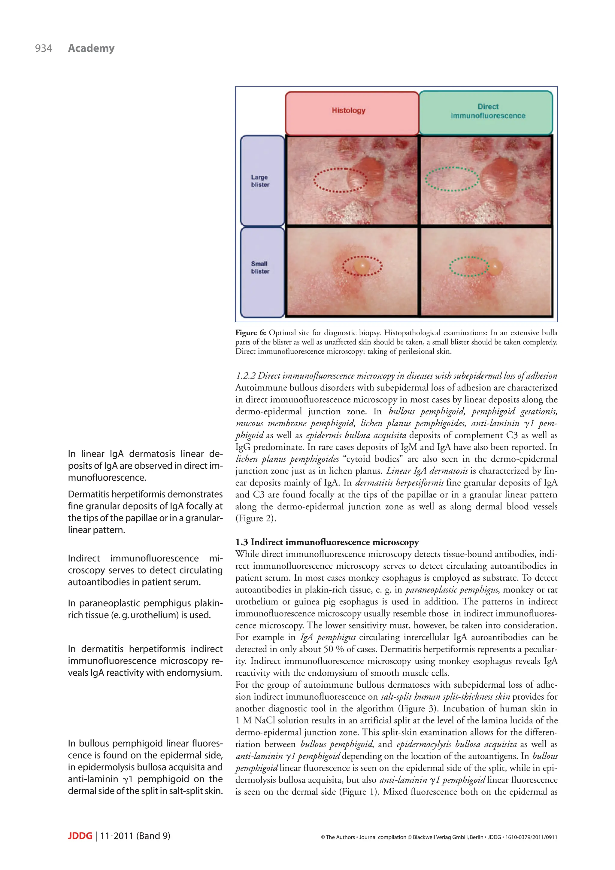 Autoimmune bullous skin diseases. diagnosis and therapy.pdf