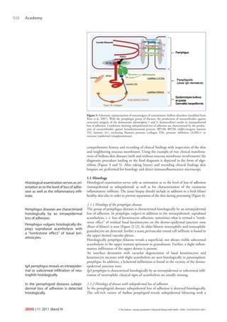 Autoimmune bullous skin diseases. diagnosis and therapy.pdf