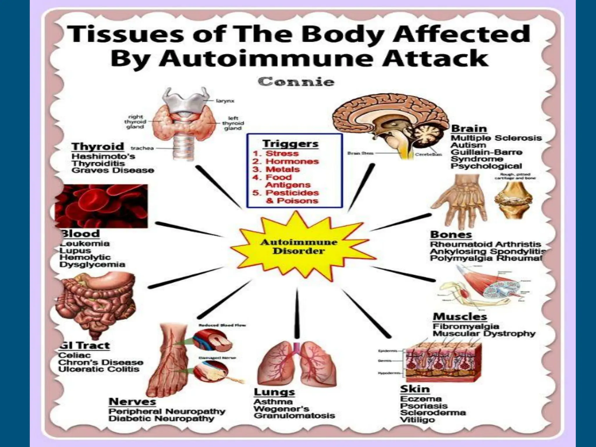 Autoimmune_disease, diagnosis and treatment | PDF