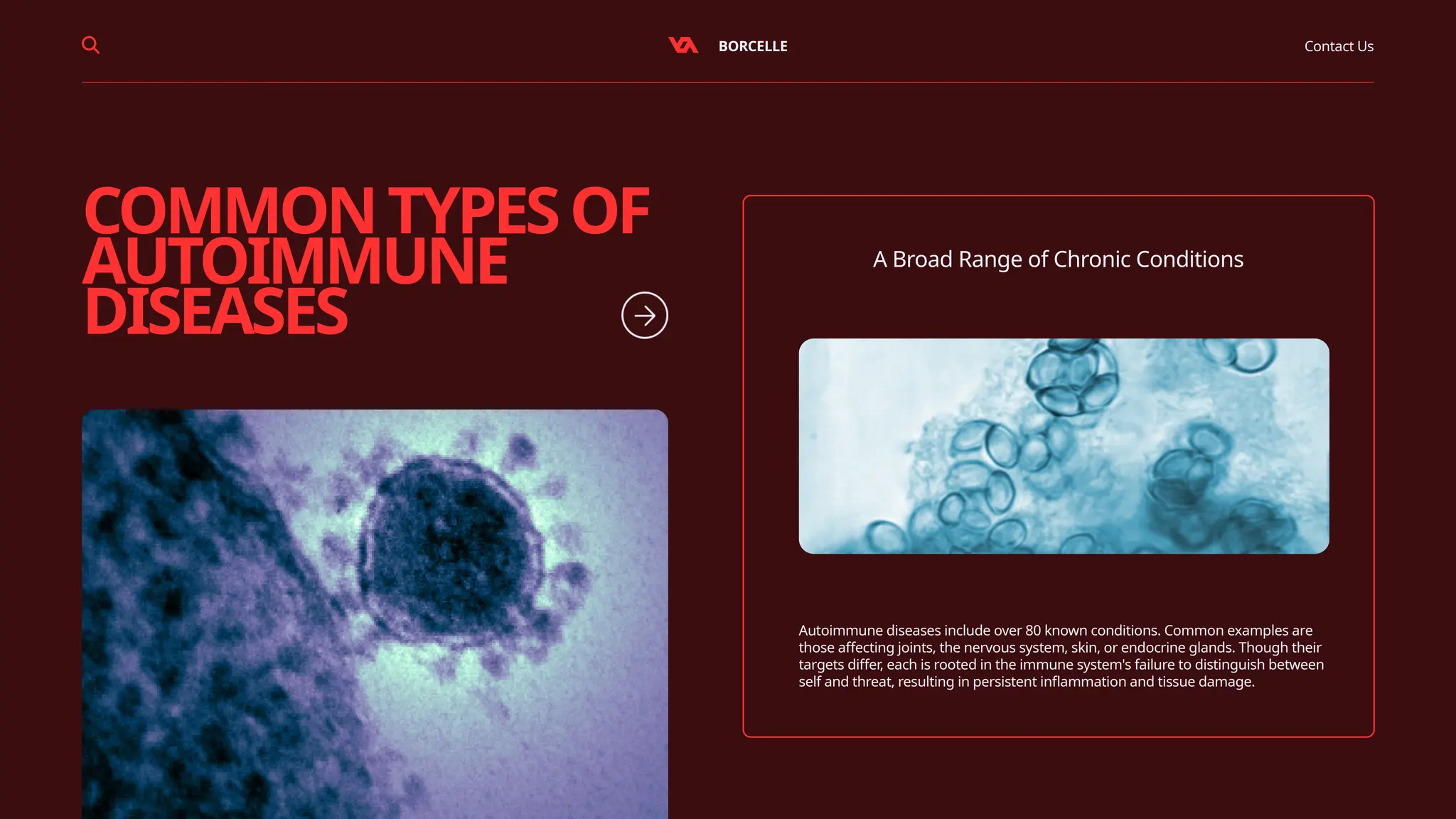 autoimmune disease.pptx how autoimmune diseases compromise immune ...