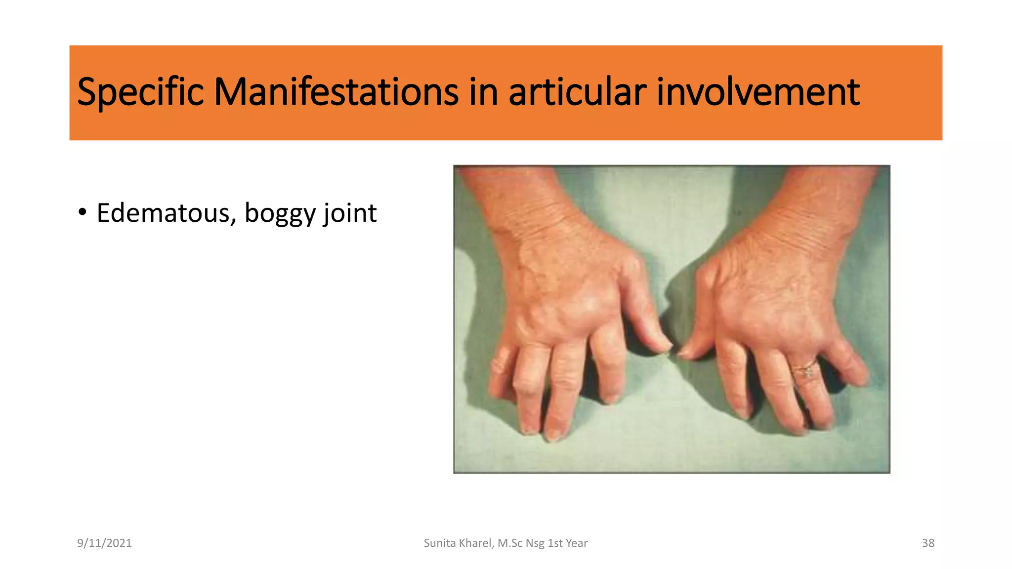 Autoimmune disease of bone | PPT