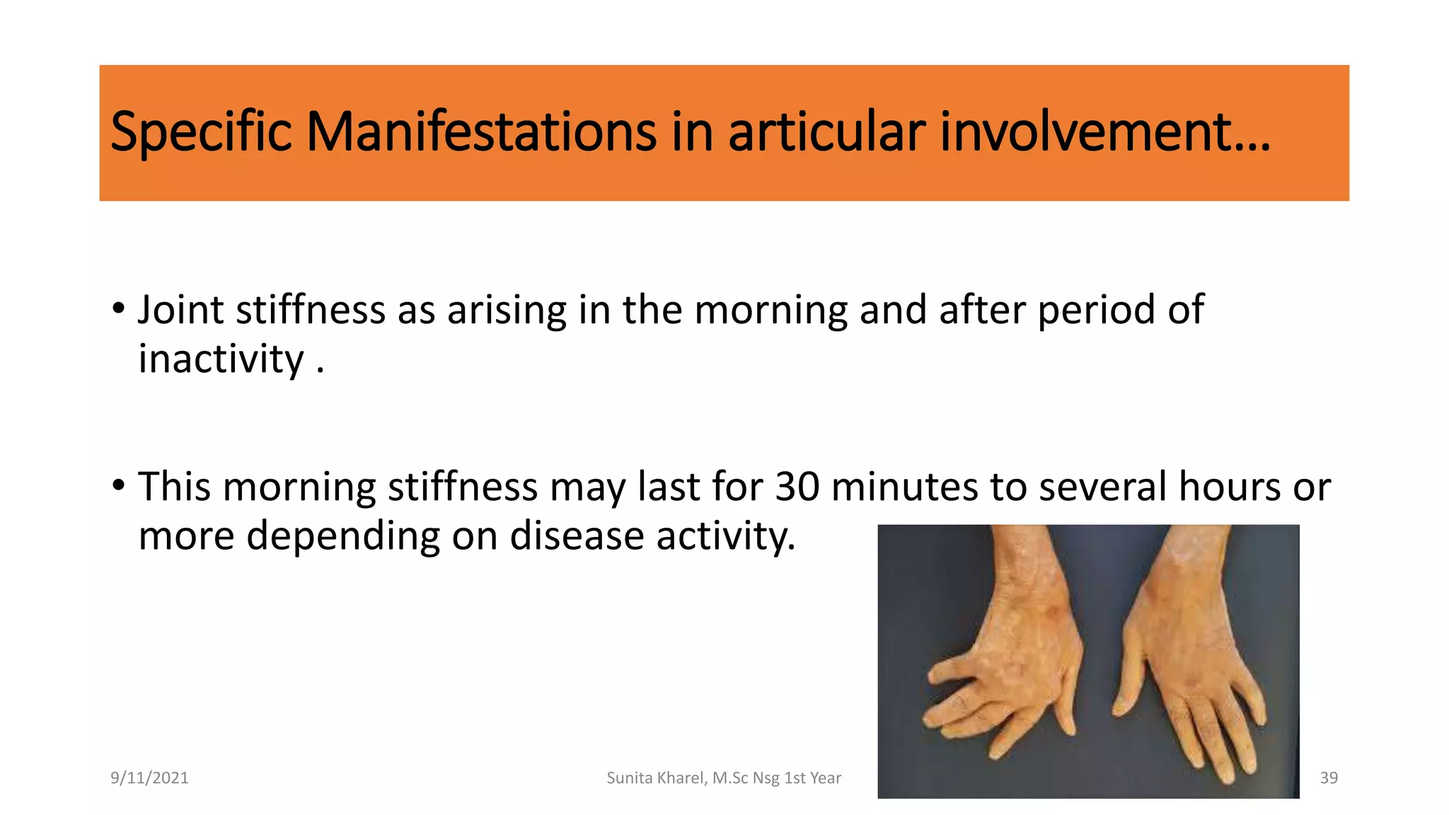 Autoimmune disease of bone | PPT