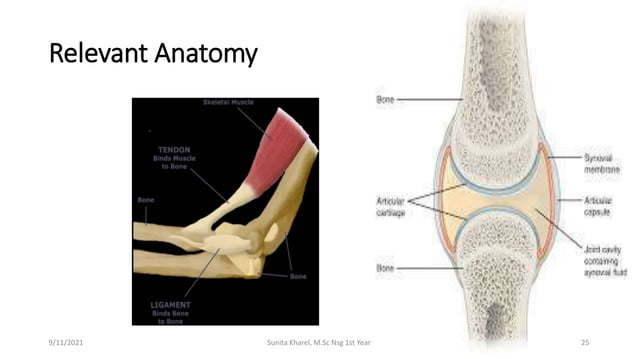 Autoimmune disease of bone | PPT