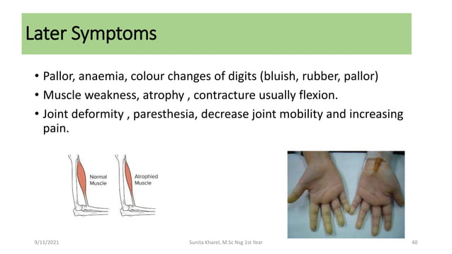 Autoimmune disease of bone | PPT