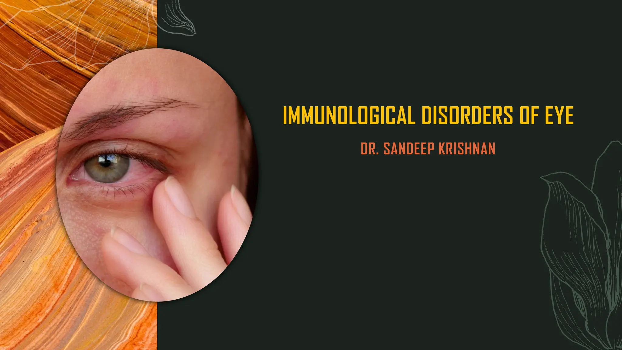 AUTOIMMUNE DISEASE OF EYE.presentation ppt | PPT