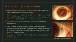 AUTOIMMUNE DISEASE OF EYE.presentation ppt | PPT