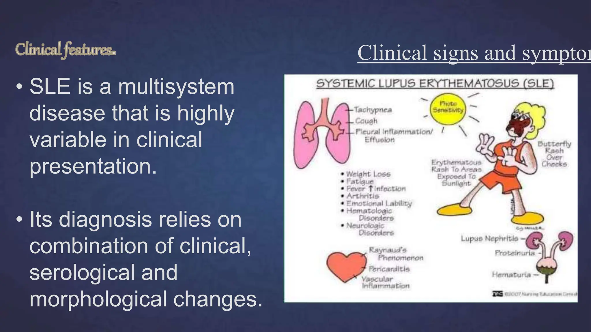 Autoimmune disease ppt.pptx for students | PPTX