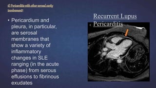 Autoimmune disease ppt.pptx for students | PPTX