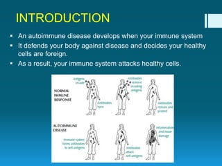 Autoimmune diseases | PPT