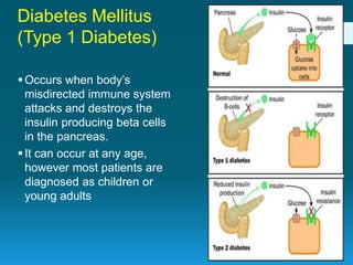 Autoimmune diseases | PPTX