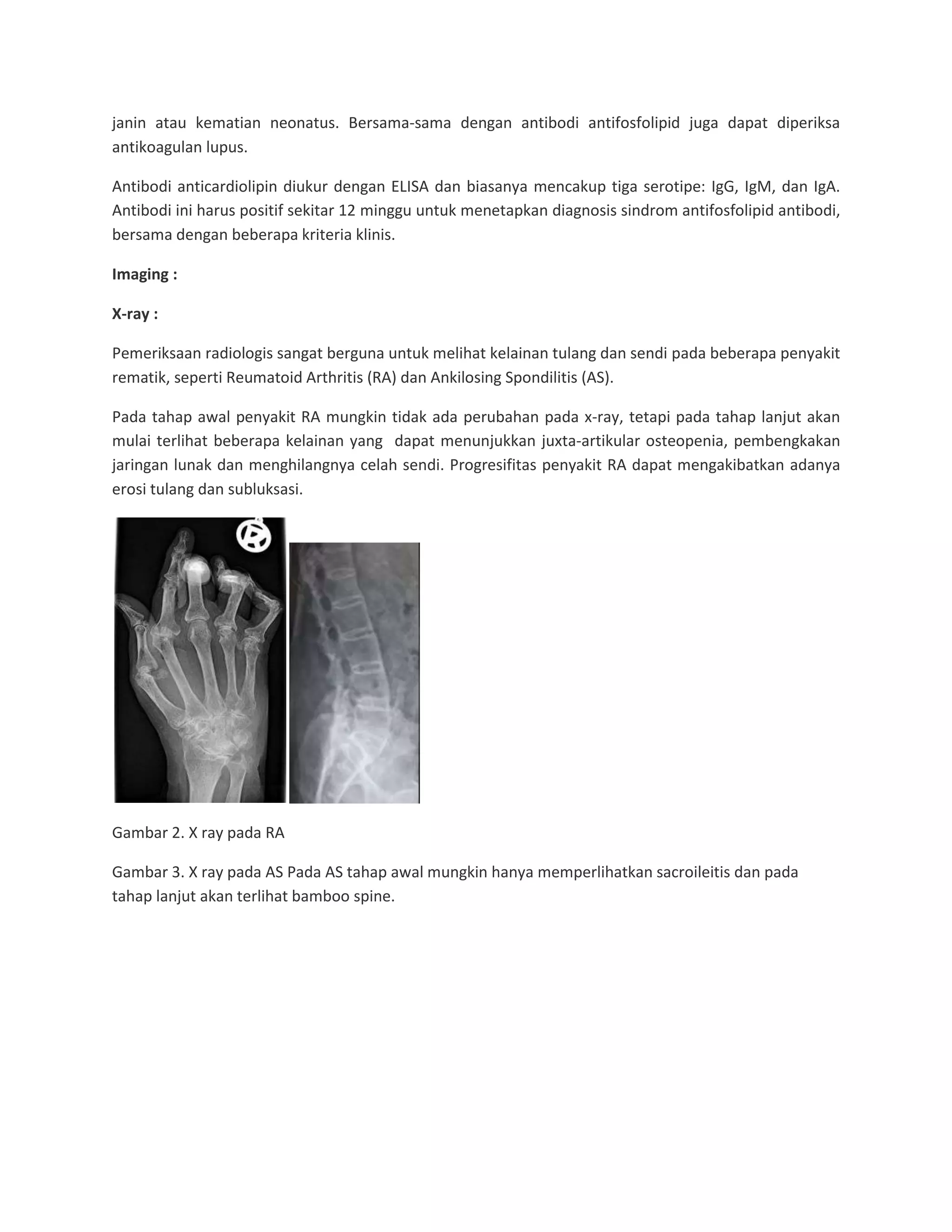 Autoimmune diseases clinical spectrum and diagnosis approach | DOCX