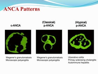 Autoimmune diseases diagnostic challenges | PPTX