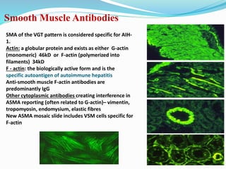 Autoimmune diseases diagnostic challenges | PPTX