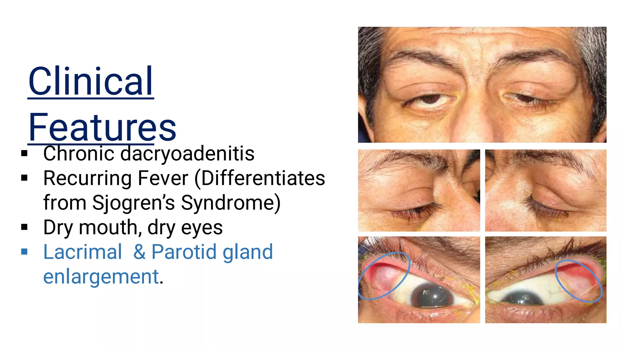 Autoimmune diseases of oral cavity | PDF