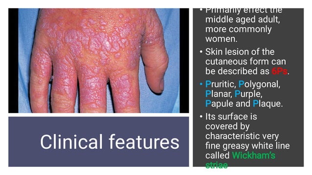 Autoimmune diseases of oral cavity | PDF | Ear, Nose and Throat ...