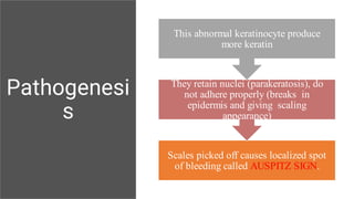 Autoimmune diseases of oral cavity | PDF