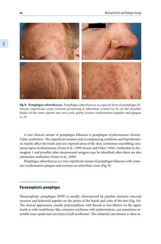 Autoimmune Diseases of the Skin_ Pathogenesis, Diagnosis, Management ...